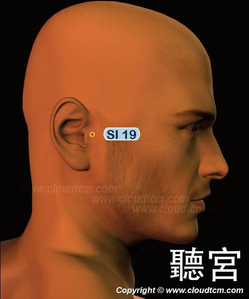 聽宮穴改善耳鳴耳聾,眩暈,牙齒痛癲狂 - 雲端中醫養生